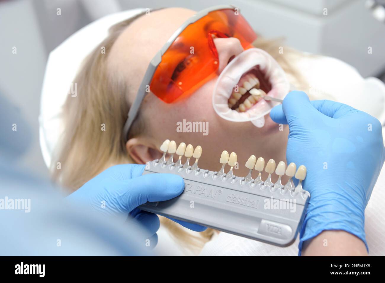 Optragate mouth dilator hi-res stock photography and images - Alamy