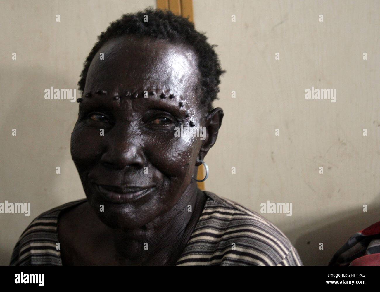 An aging refugee woman with the traditional scarifications of the ...