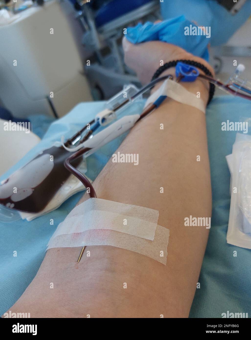 blood donor arm with big needle in arm during donation at hospital ...