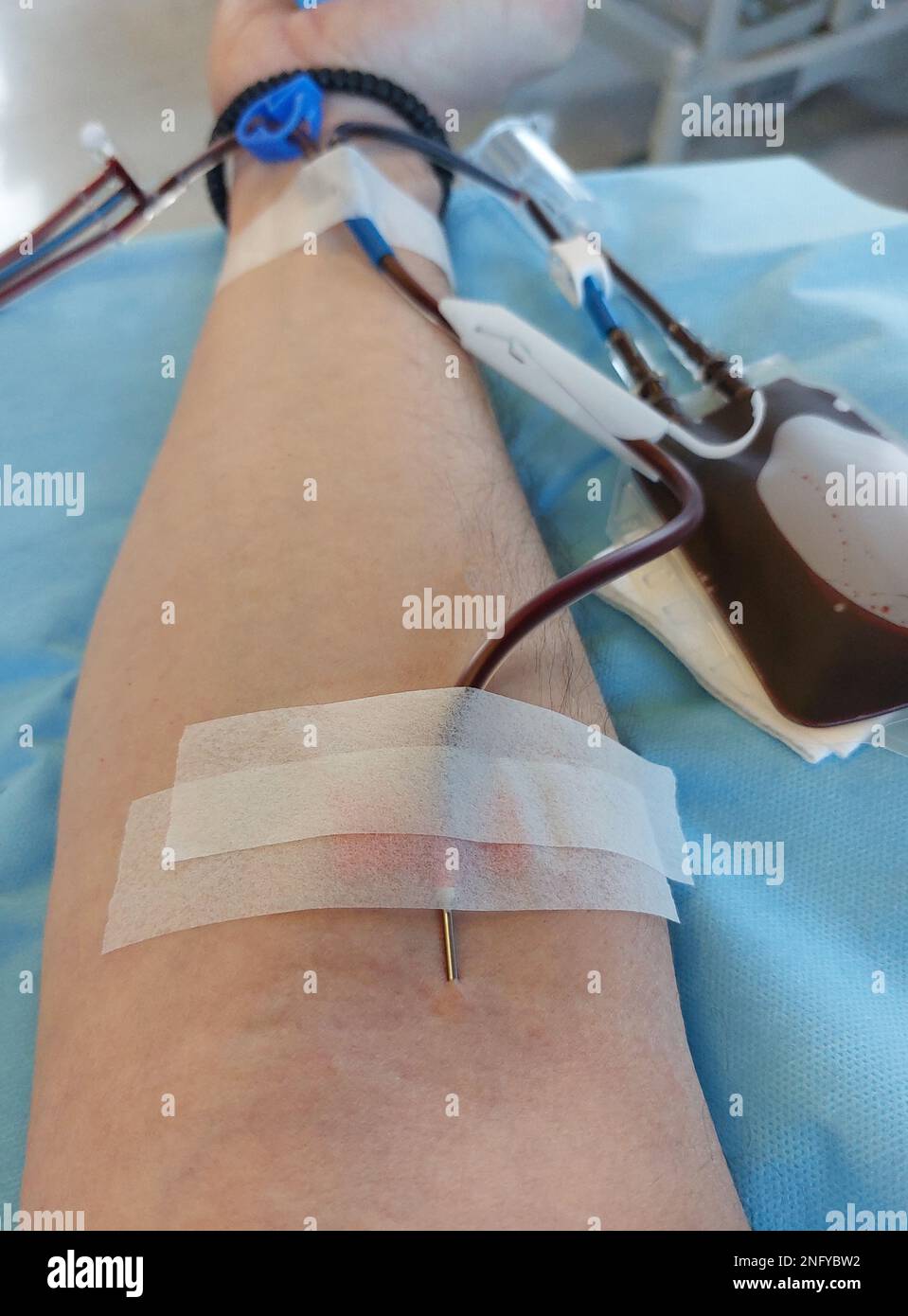 needle stuck in blood young person arm during blood transfusion at ...