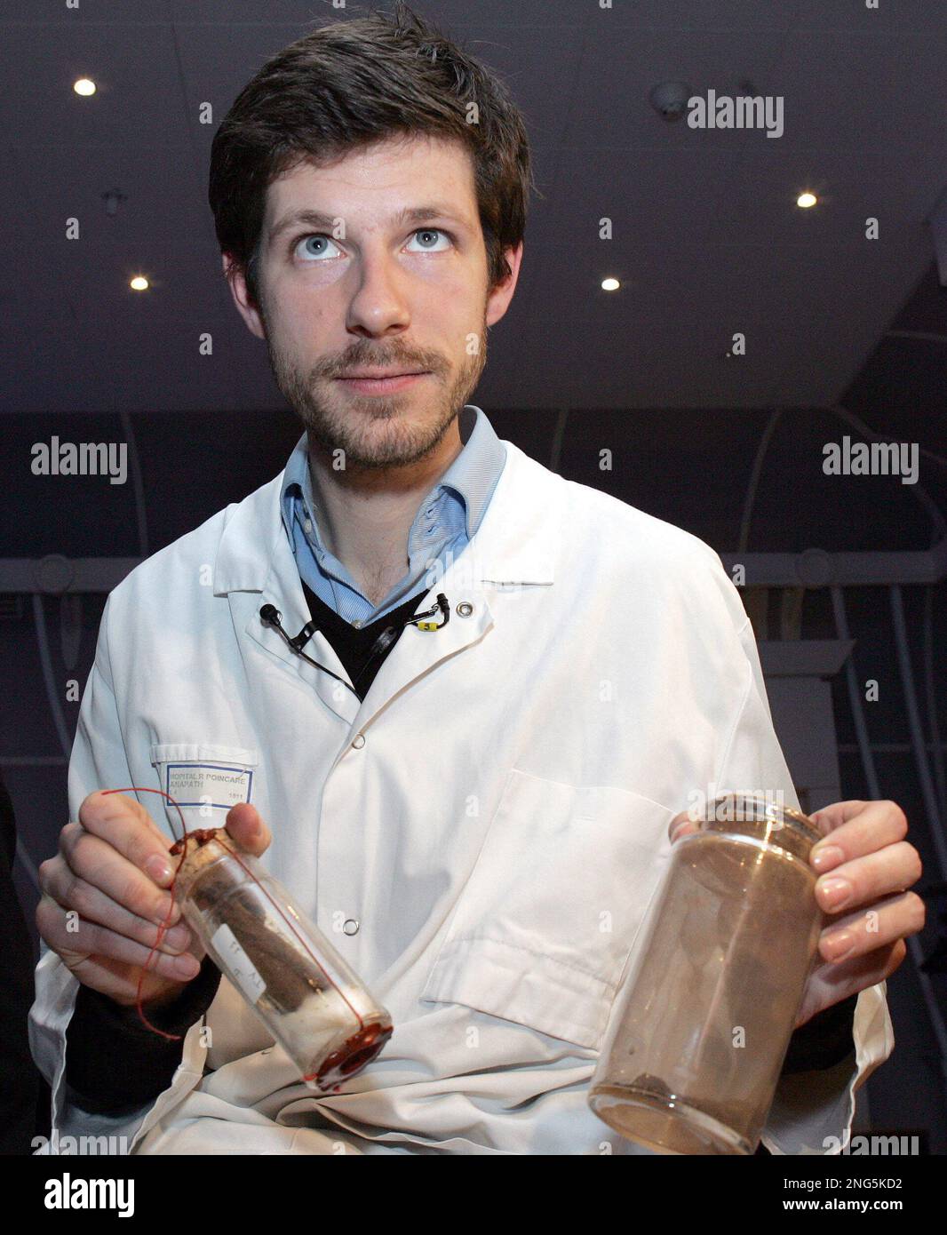 ** FILE ** French Dr. Philippe Charlier displays the supposed remains ...