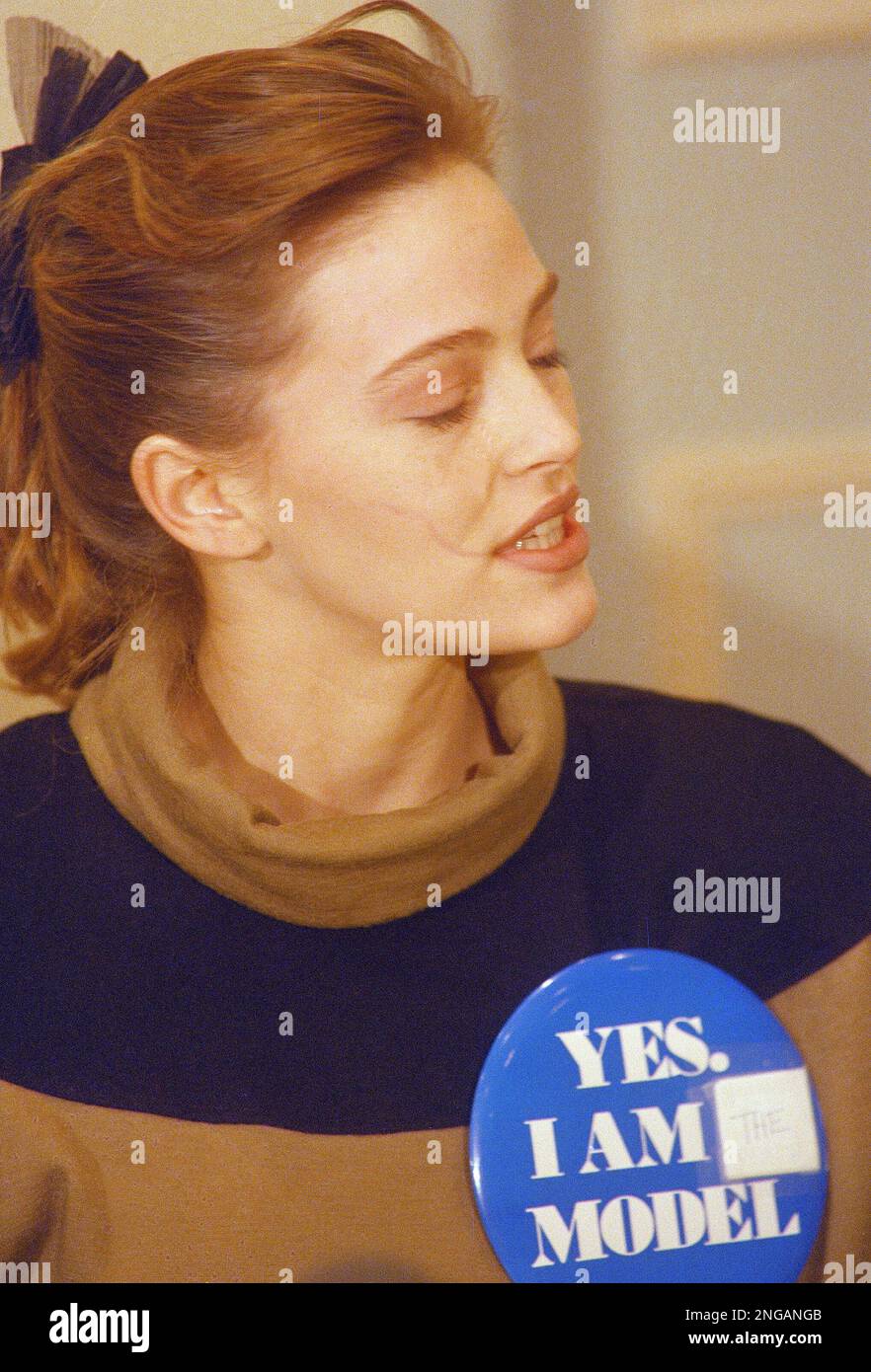 Marla Hanson, the New York fashion model who had to have over 150 ...