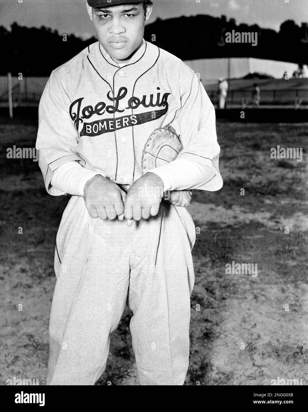 Heavyweight champion Joe Louis shows a swollen right hand and a ...