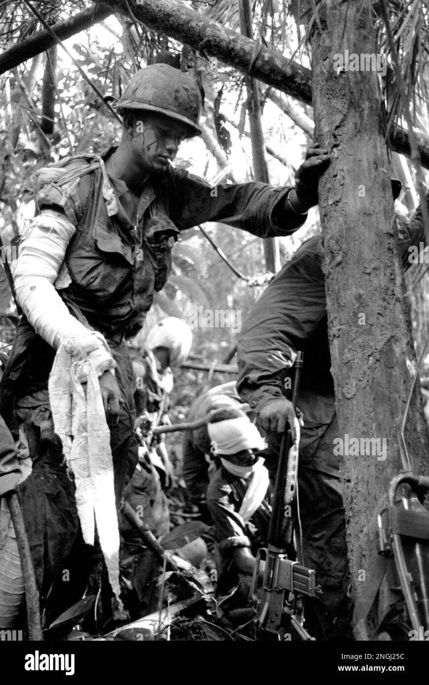 A U.S. trooper of the 173rd Airborne Brigade, bleeding from a slight ...
