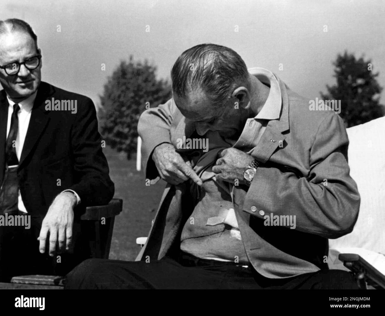 U.S. President Lyndon Baines Johnson displays the incision from his ...