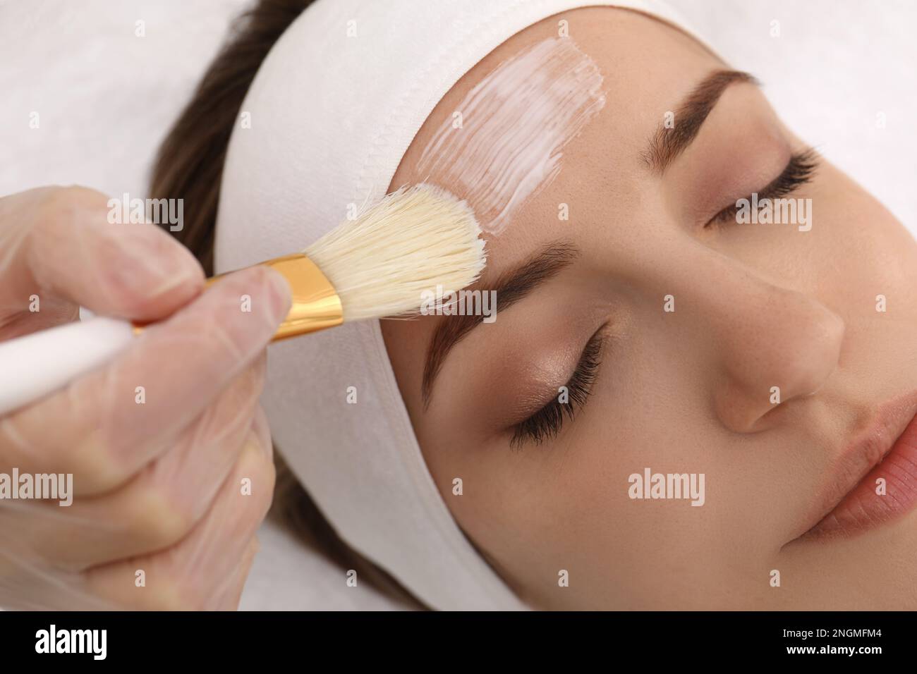 Young woman during face peeling procedure in salon, closeup Stock Photo ...