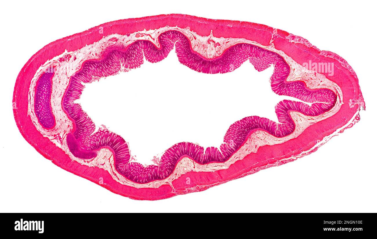 Vermiform Appendix Histology