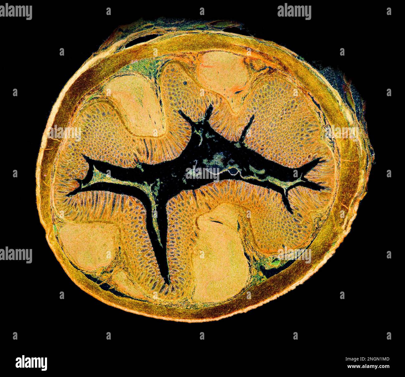 The cecum or caecum is a pouch within the peritoneum that is considered ...
