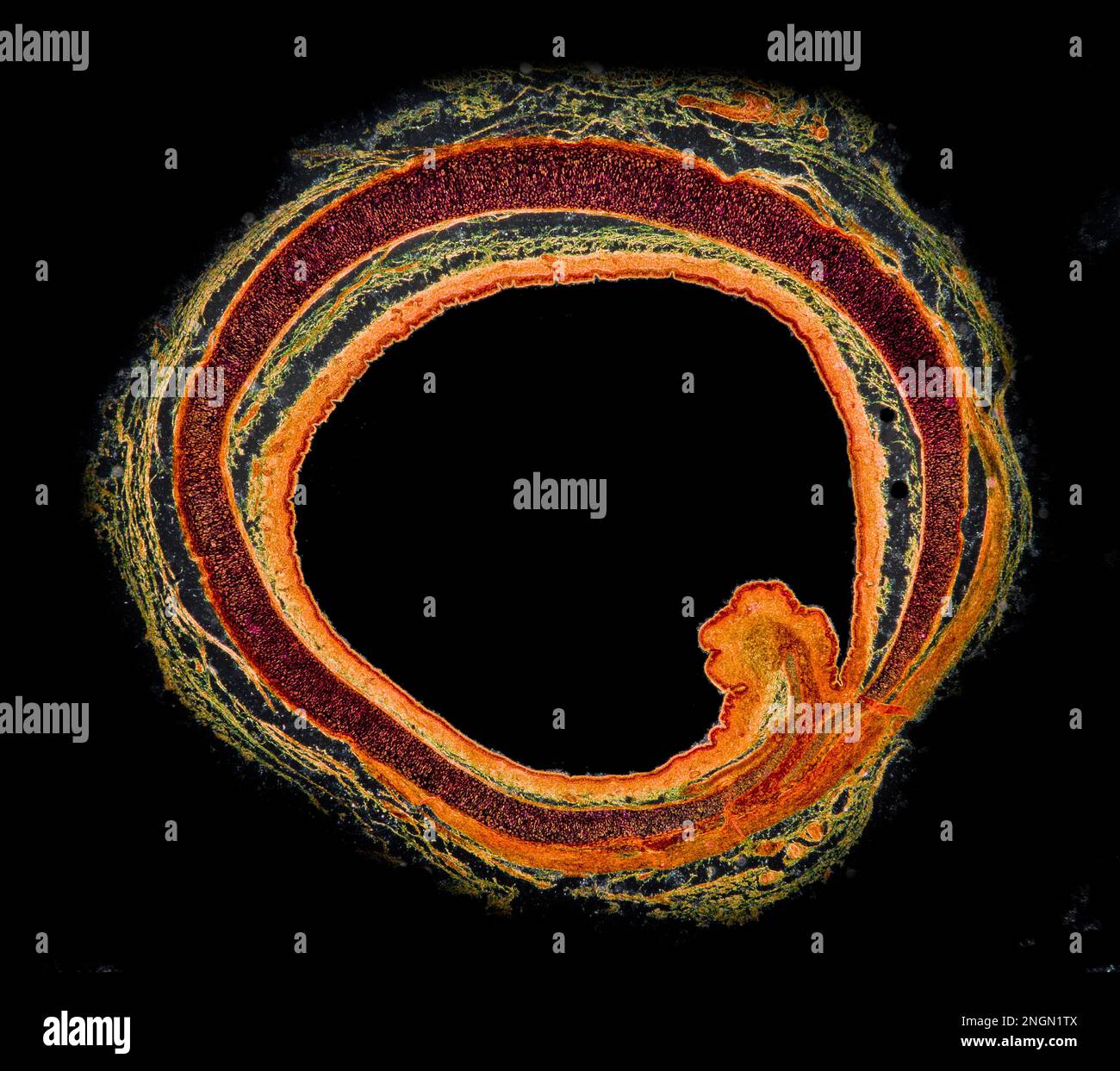 Trachea micrograph hi-res stock photography and images - Alamy