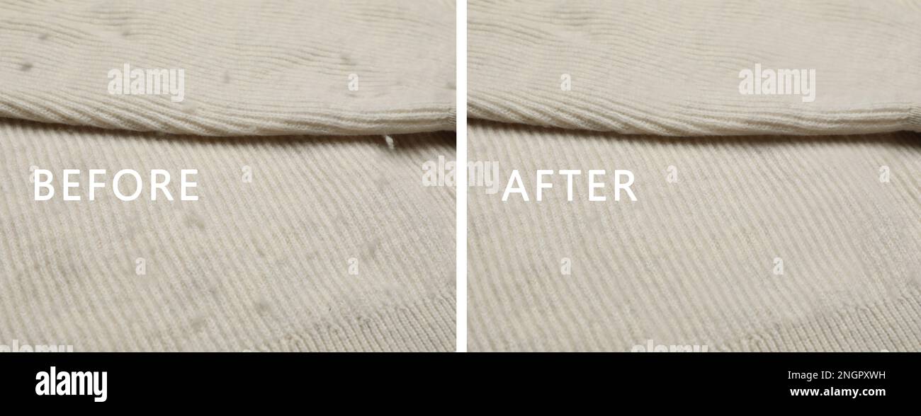 Light cloth before and after using of fabric shaver, collage. Banner ...