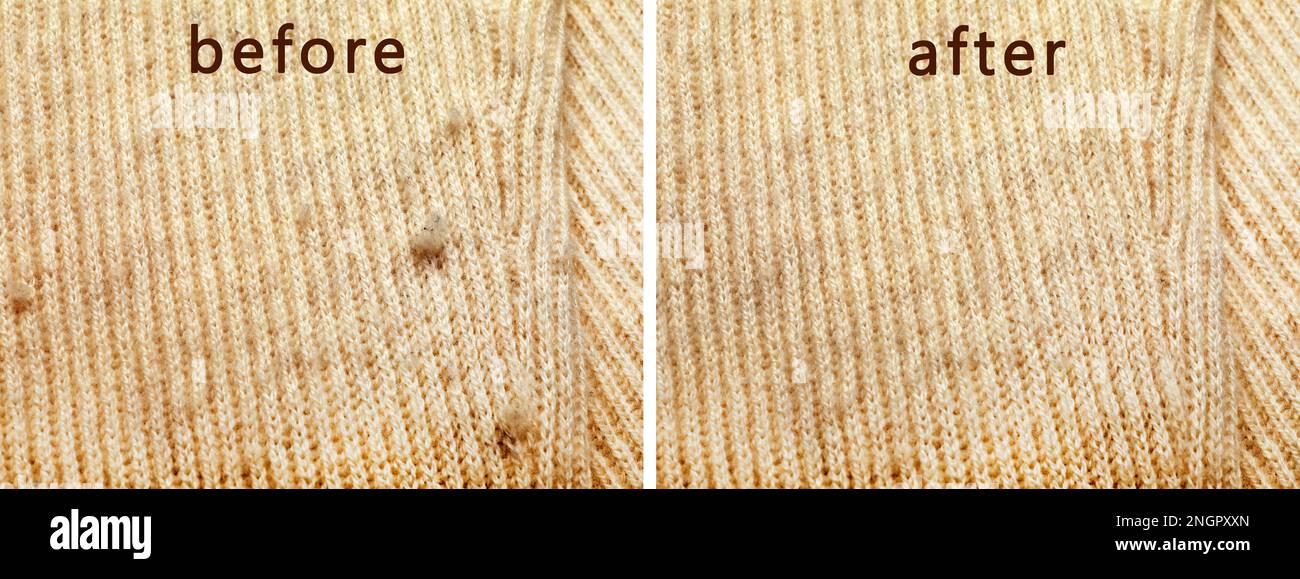 Light cloth before and after using of fabric shaver, collage. Banner ...