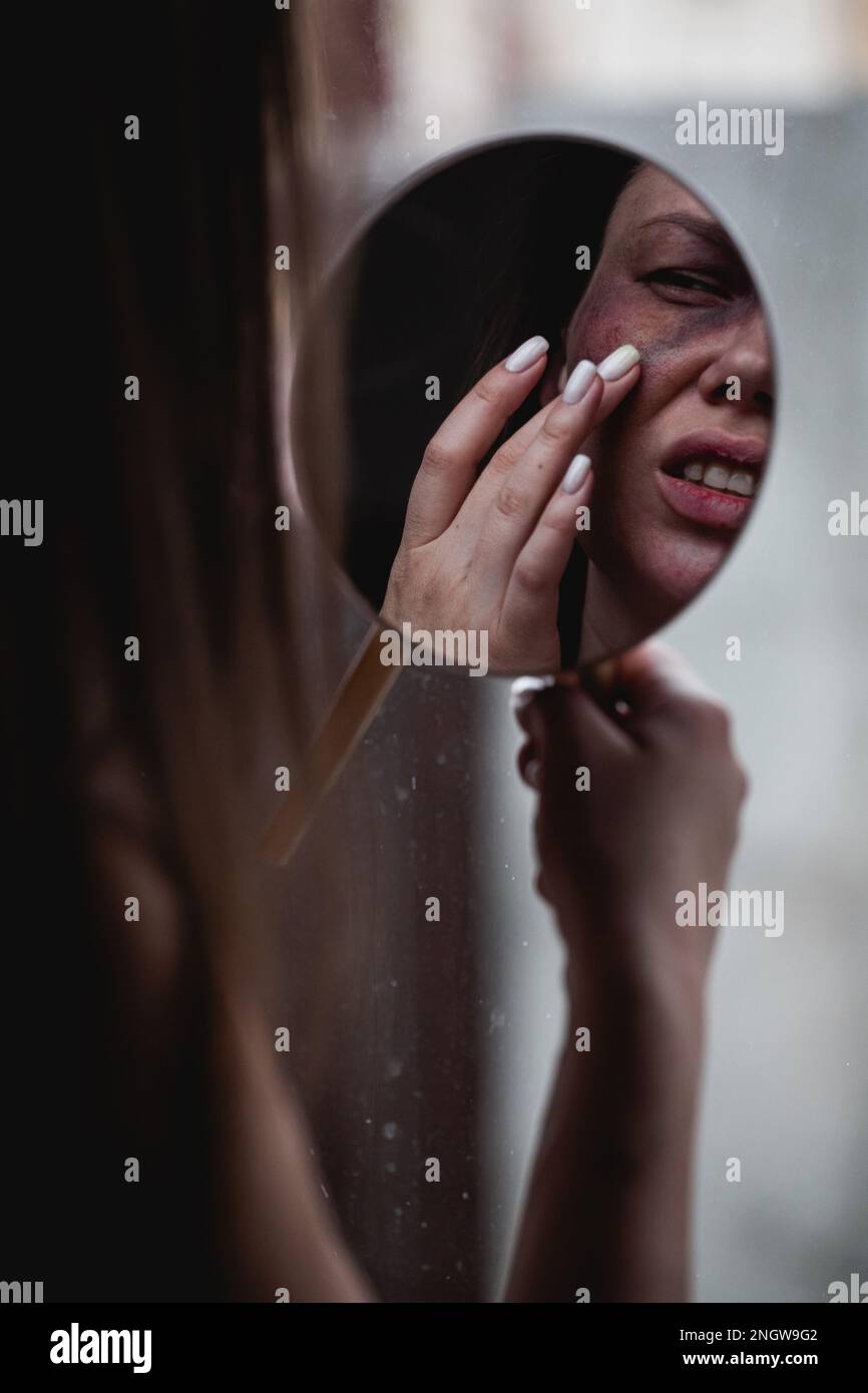 Domestic violence, abuse woman with bruise on face by the window looks ...