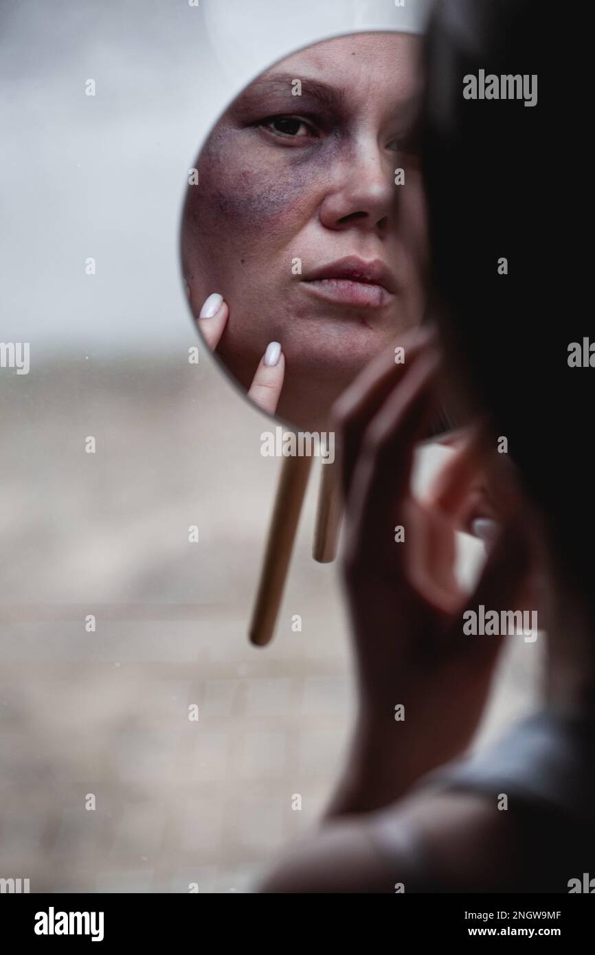Domestic violence, abuse woman with bruise on face by the window looks ...