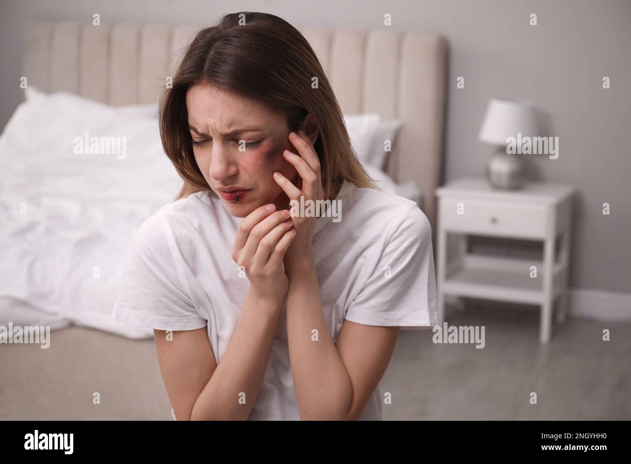 Facial injuries hi-res stock photography and images - Alamy