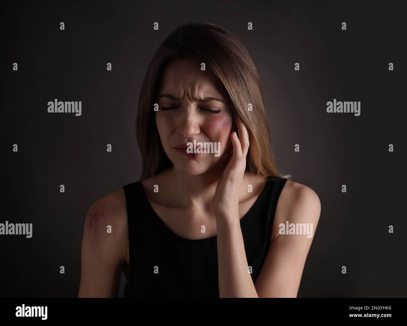 Woman with facial injuries on black background. Domestic violence ...