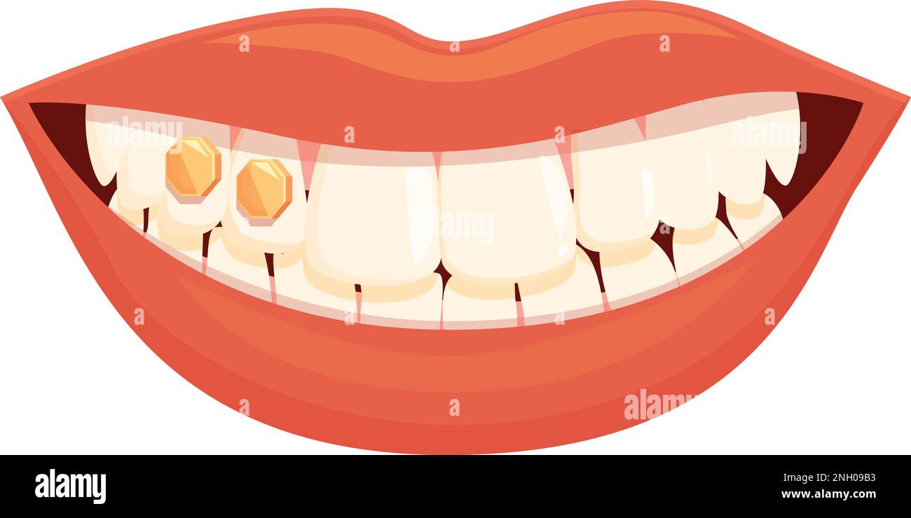 Tooth gem implant icon cartoon vector. Dental care. Health dentist ...