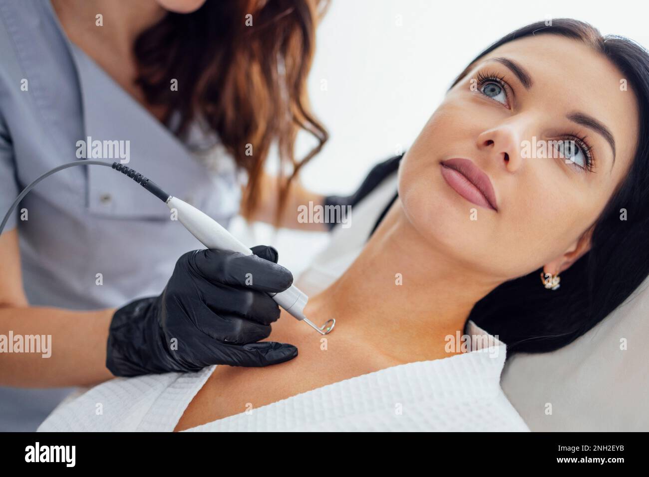 Beautiful caucasian young woman is doing a mole removal procedure in a ...