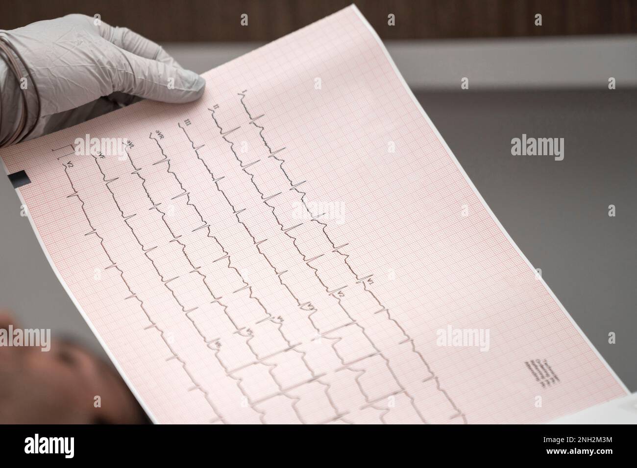 Ekg printout hi-res stock photography and images - Alamy
