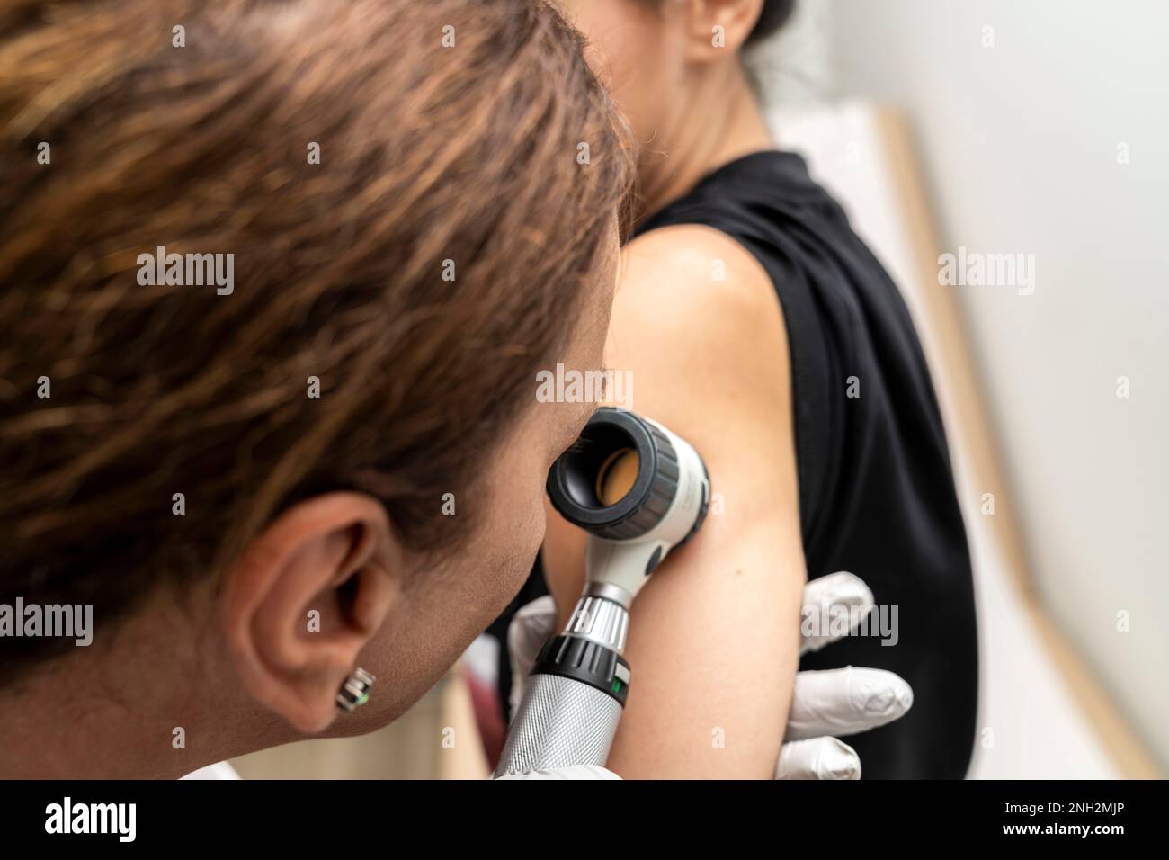 Dermatology dermatoscope hi-res stock photography and images - Alamy