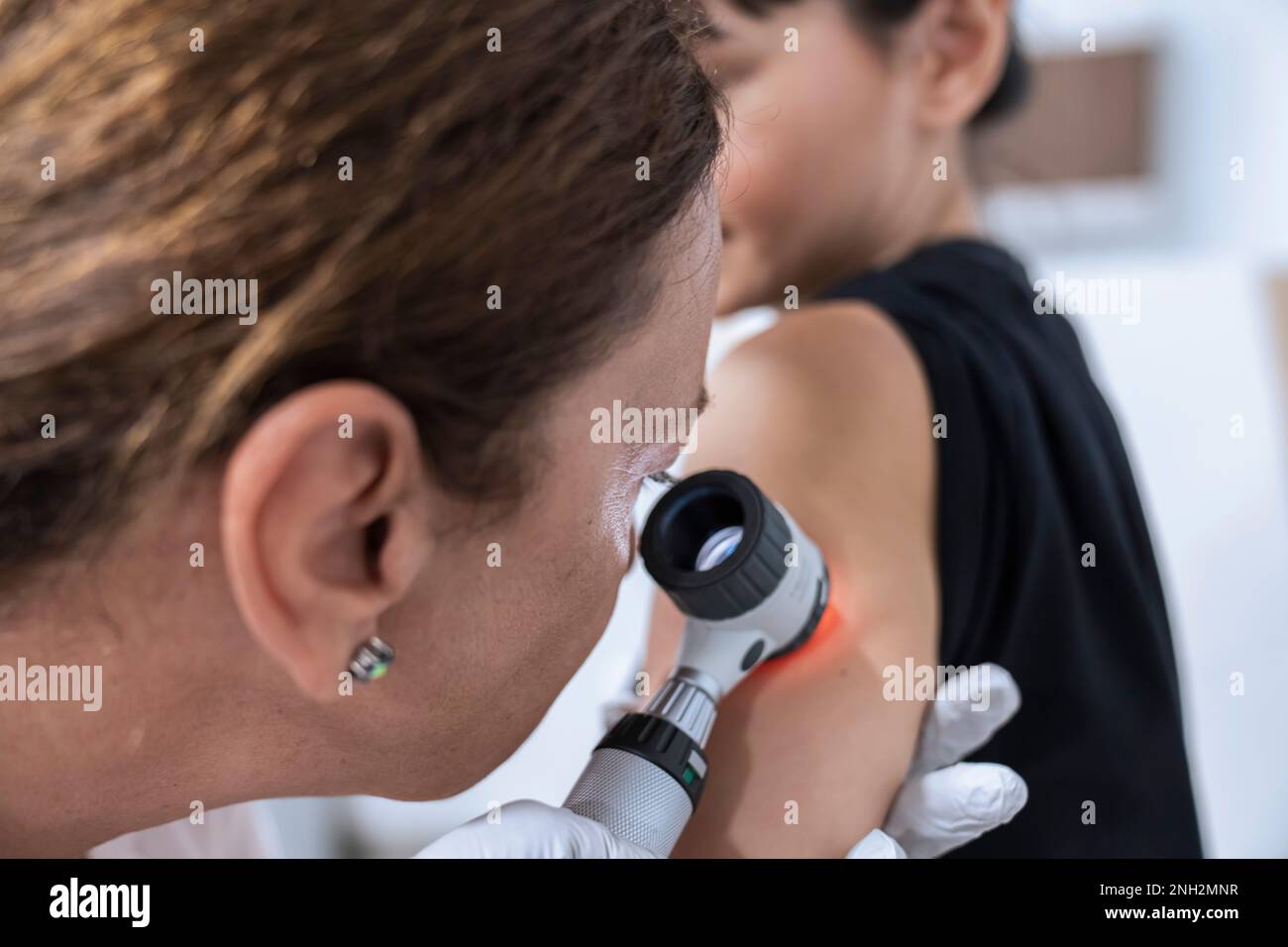 Dermatoscopy hi-res stock photography and images - Alamy