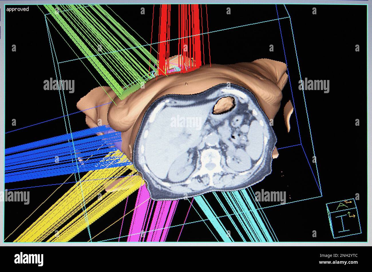 Beam field imaging hi-res stock photography and images - Alamy