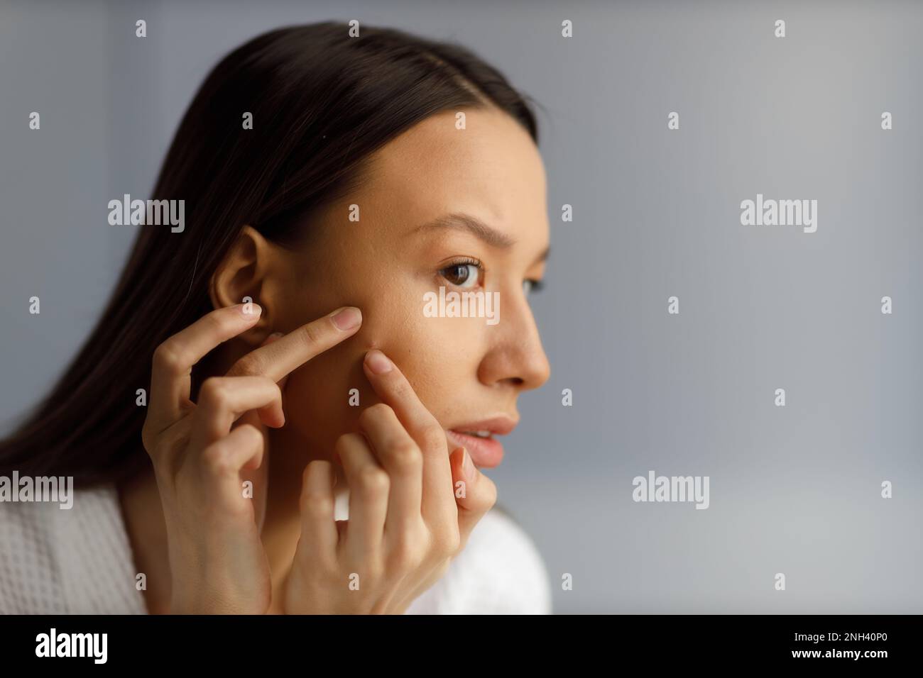 Attractive upset young woman in white bathrobe examines pimples on her ...