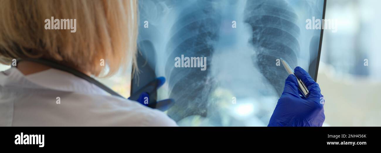 Medical assistant or radiologist holds pointer for examination and ...