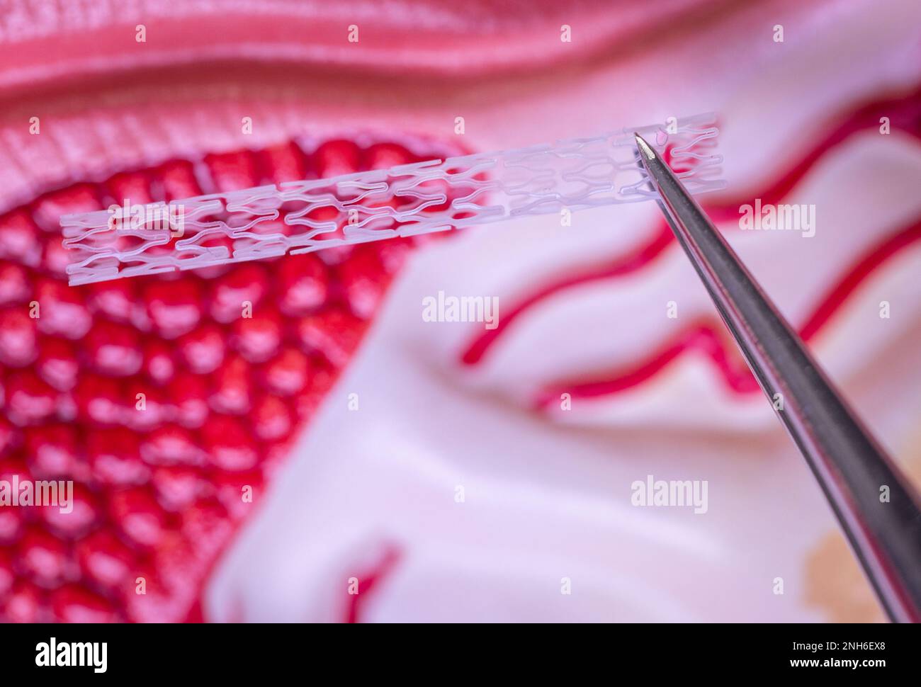 07 February 2023, Mecklenburg-Western Pomerania, Warnemünde: A special ...