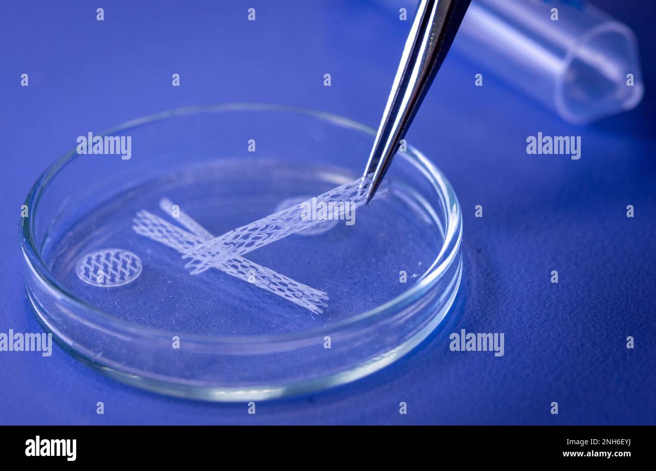 Fallopian tubes hi-res stock photography and images - Alamy