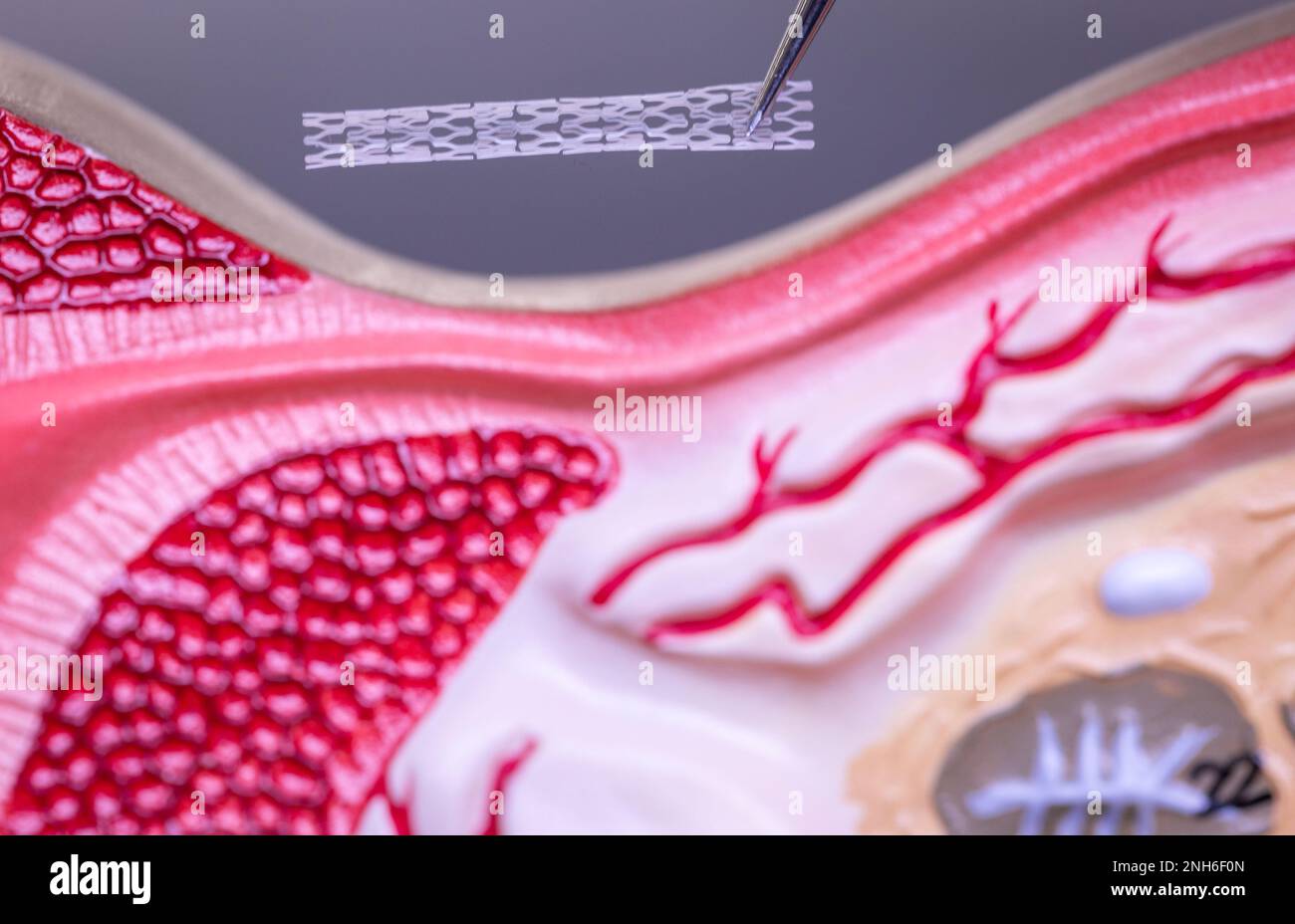 07 February 2023, Mecklenburg-Western Pomerania, Warnemünde: A special ...