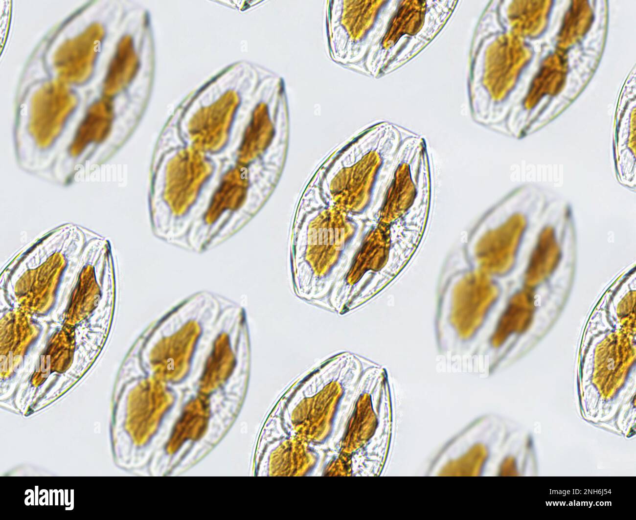 Amphora sp. algae under microscopic view pattern, Diatoms ...