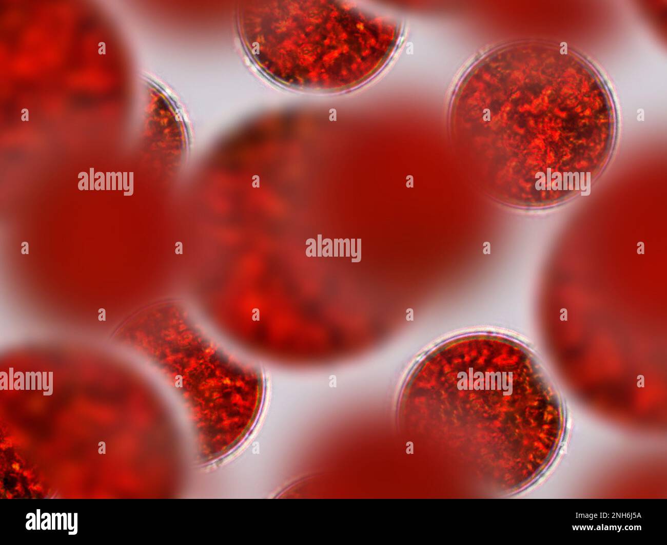 Haematococcus pluvialis cyst algae under microscopic view - haematocyst ...