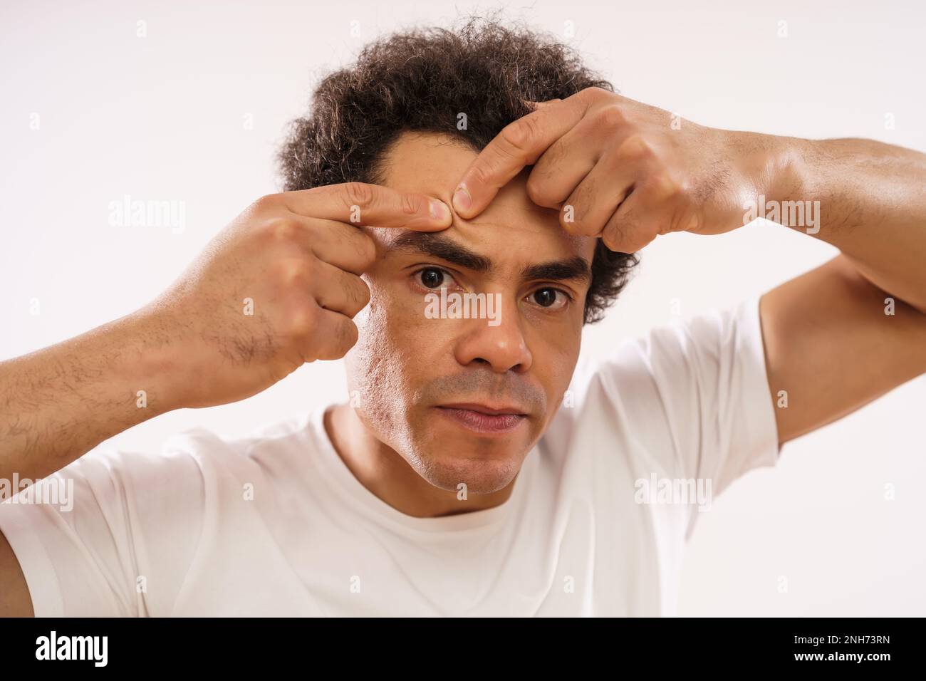 Mixed race man is squeezing pimple on his forehead Stock Photo - Alamy