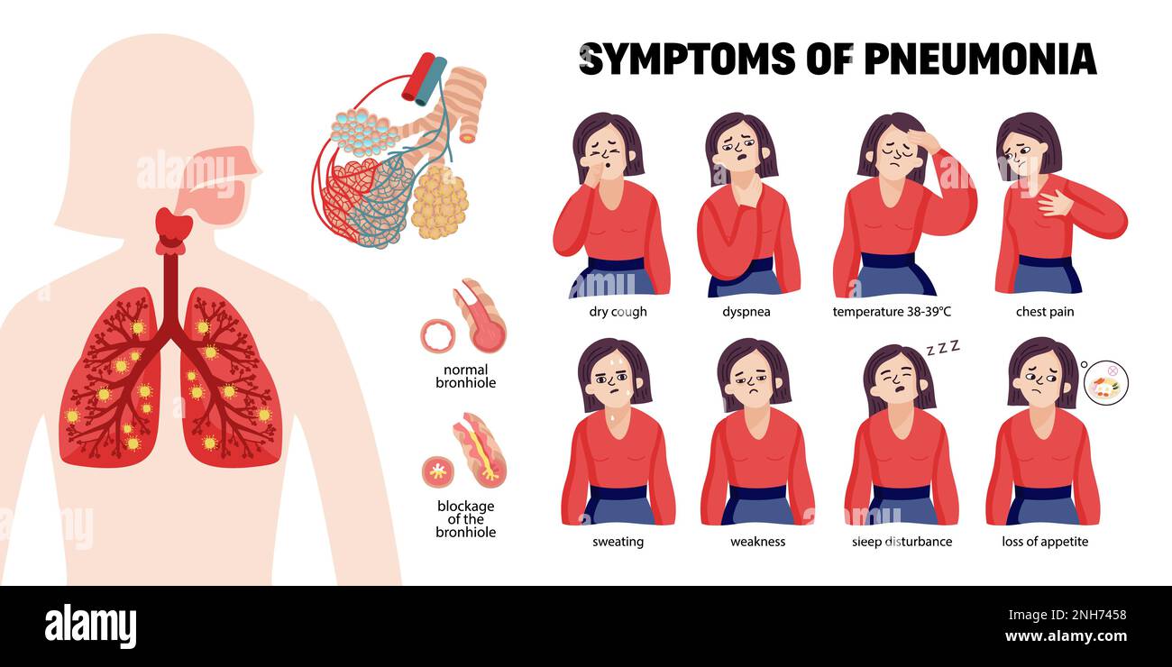Human pneumonia infographics with female characters representing common ...