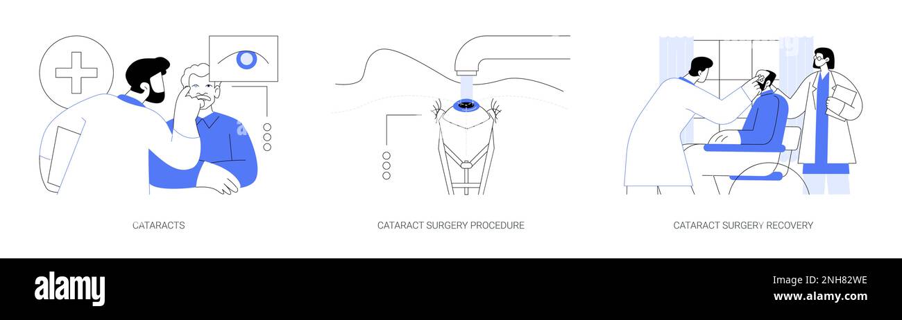 Cataract eye surgery abstract concept vector illustrations Stock Vector ...