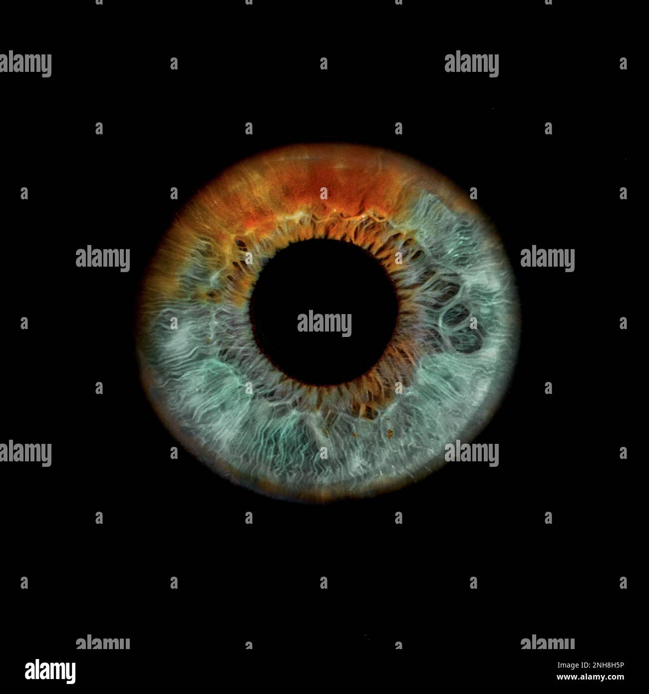 Heterochromia iris hi-res stock photography and images - Alamy