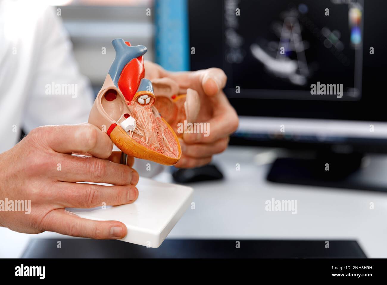 Anatomical model of the human heart in doctor's hands. Cardiological ...
