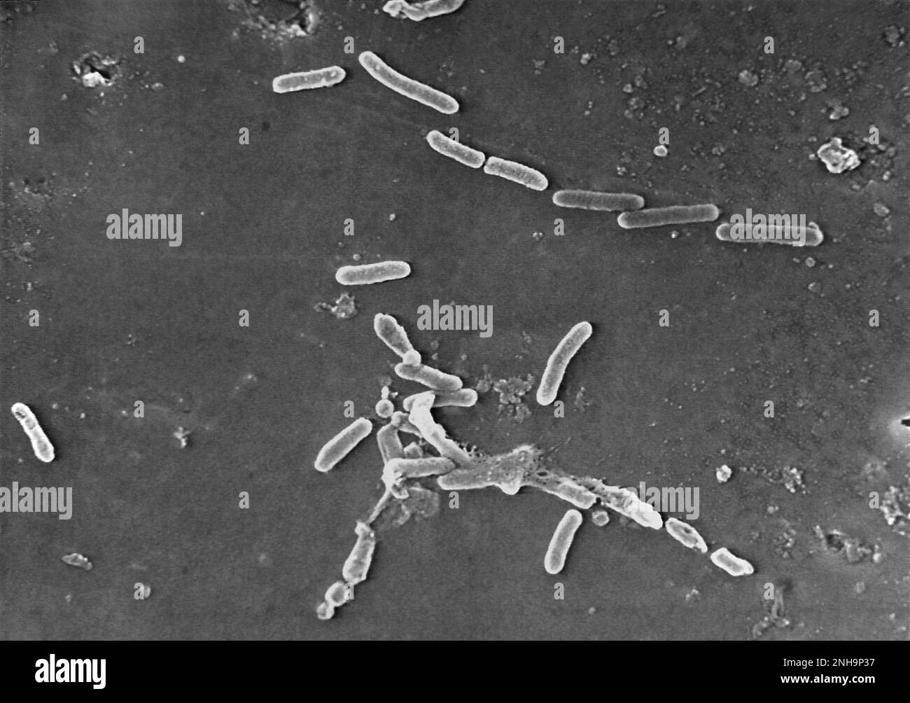 Electron microscope image of bacteria hi-res stock photography and ...