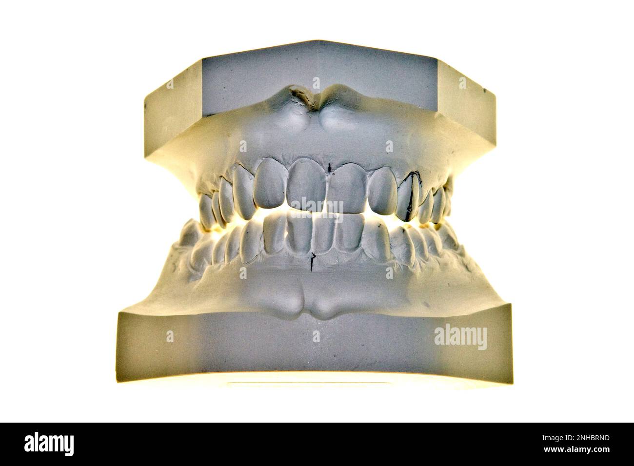 Impressions of teeth Cut Out Stock Images & Pictures - Alamy