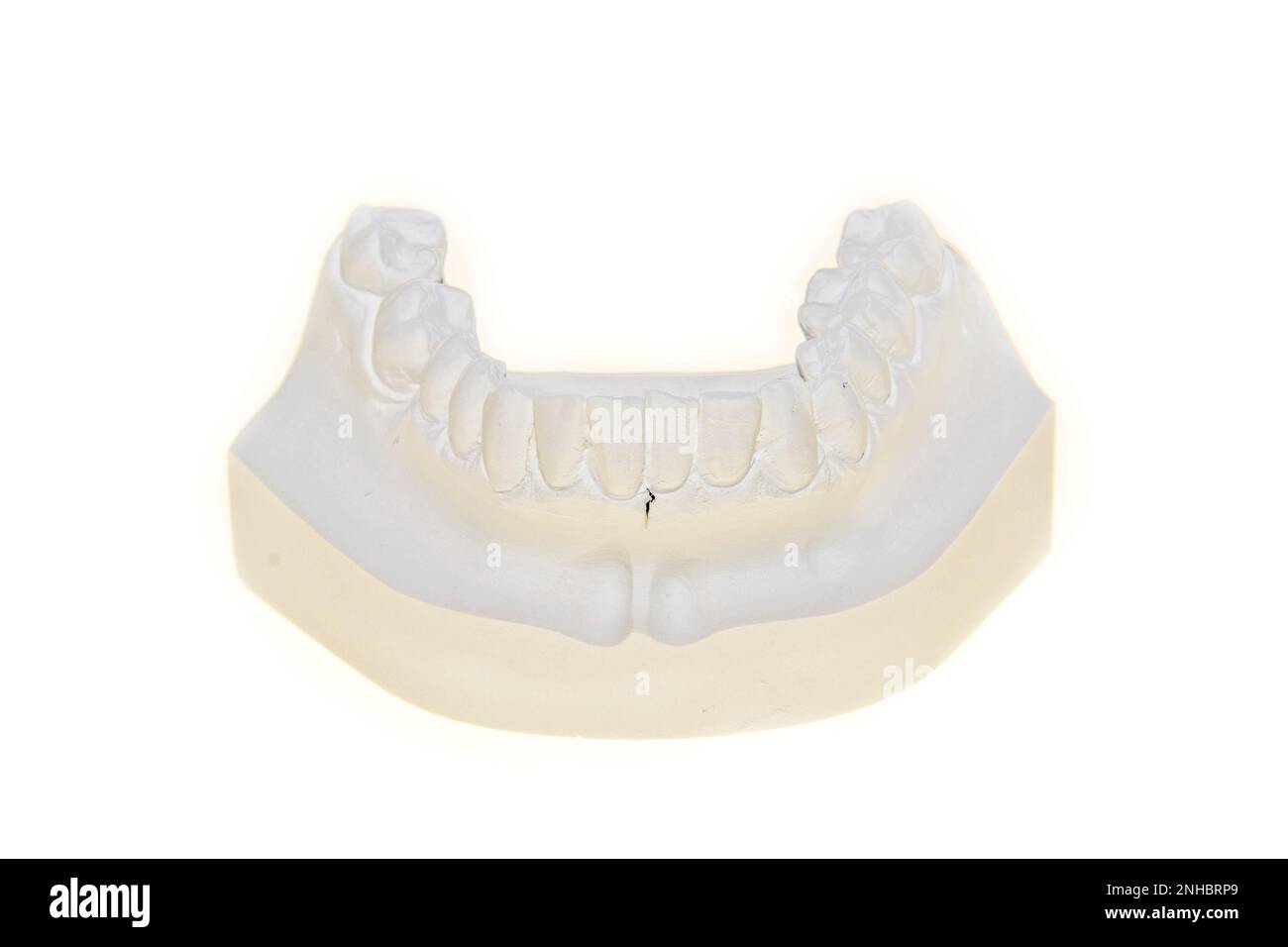 Dental impressions hi-res stock photography and images - Alamy