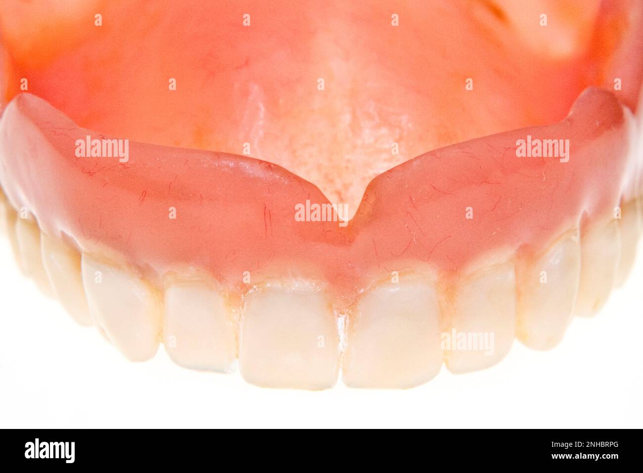 Teeth prosthesis hi-res stock photography and images - Alamy