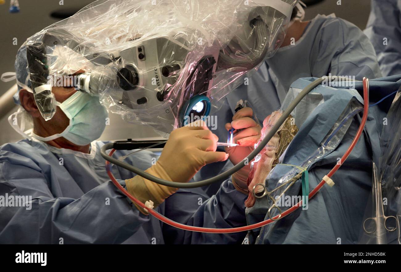 Dr. Mitchel Berger uses the Cusa Excel instrument, which removes the ...