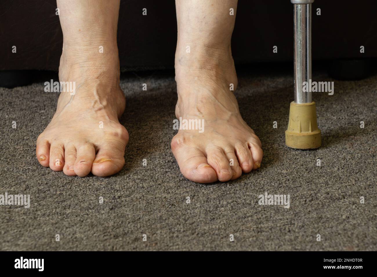 old grandmother's feet on the floor in her room close-up Stock Photo ...