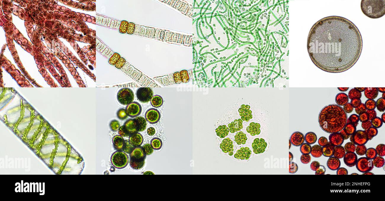 Cyanobacteria Microscopic