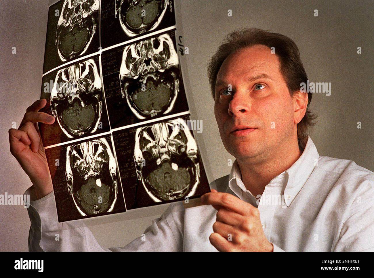 CHRONICLE 01/25/94 // TED STEFANSKI LOOKS AT MRI OF HIS SKULL FROM ...