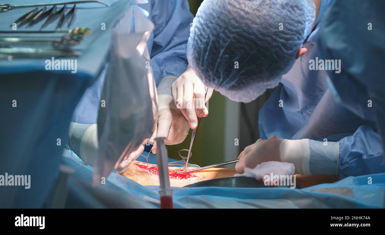 Team of professional doctors operating a patient conducting open cut ...