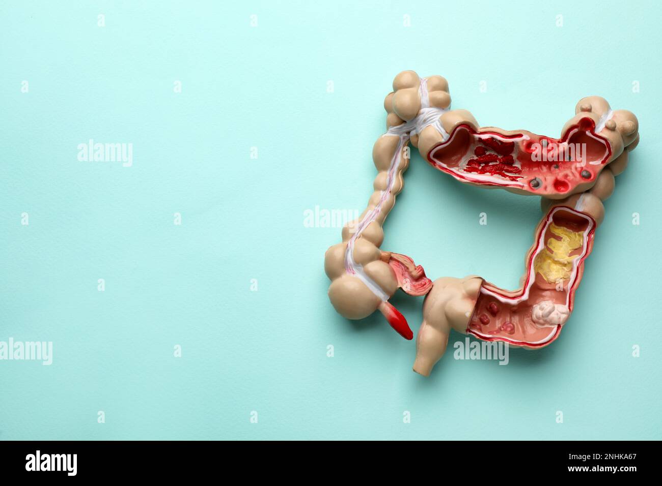 Anatomical model of large intestine on turquoise background, top view ...