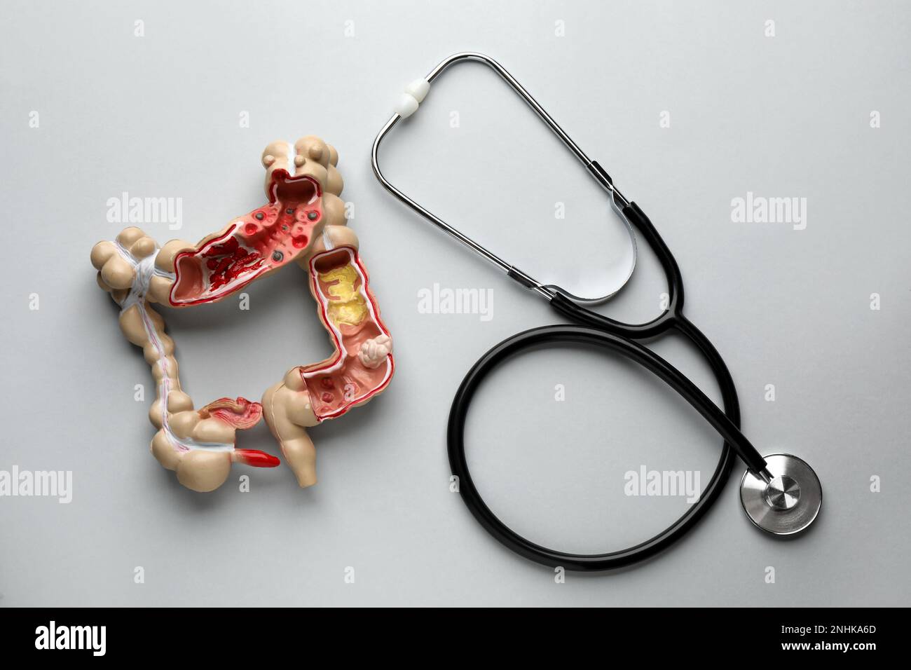 Anatomical model of large intestine and stethoscope on grey background ...