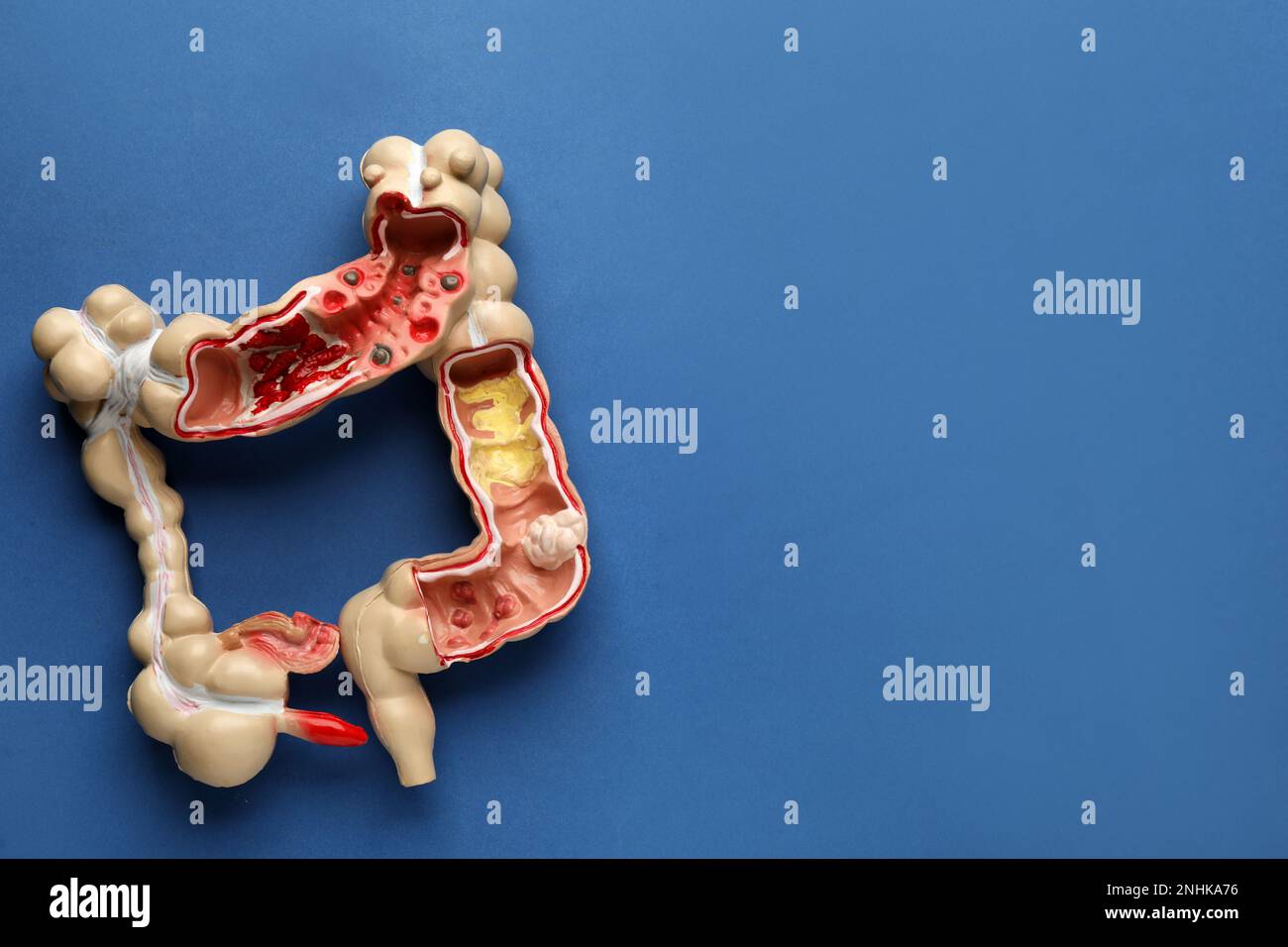 Anatomical model of large intestine on blue background, top view with ...