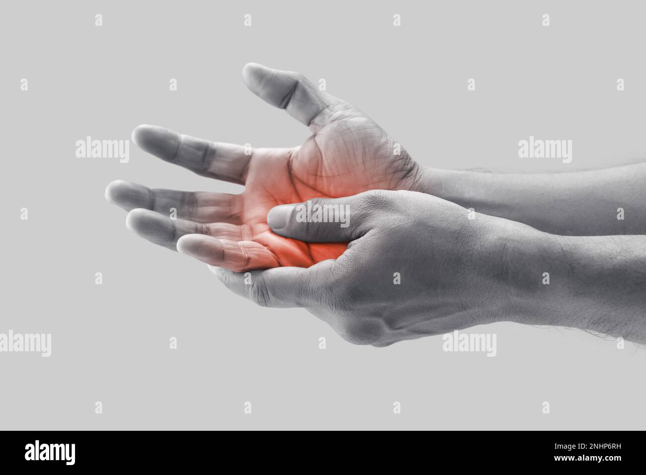 A man grab hand palm because the hand palm was injured. Hand pain. On a ...